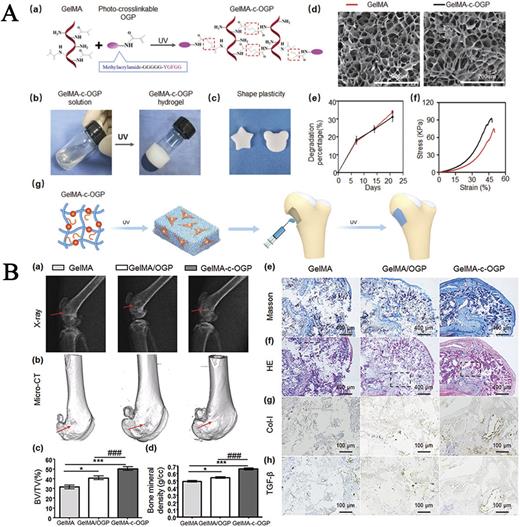 Hydrogel: A potential therapeutic material for bone tissue engineering ...