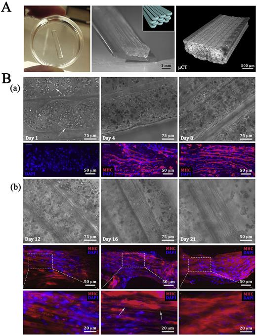Hydrogel: A potential therapeutic material for bone tissue engineering ...