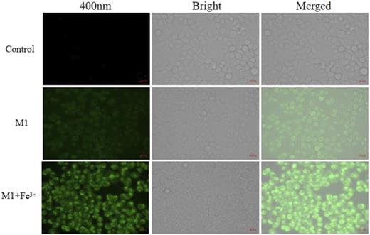 Construction and application of M1 iron ion fluorescence system based ...