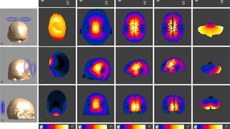 Investigating the electric field distribution in the human brain model ...