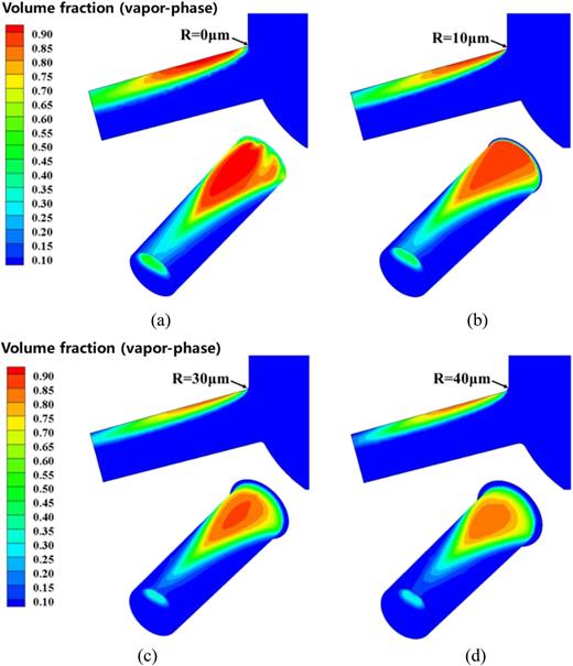 Numerical study on the cavitation flow characteristics of high-pressure fuel in injector ...