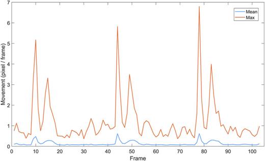 A visual detection method of cardiomyocyte relaxation and contraction ...