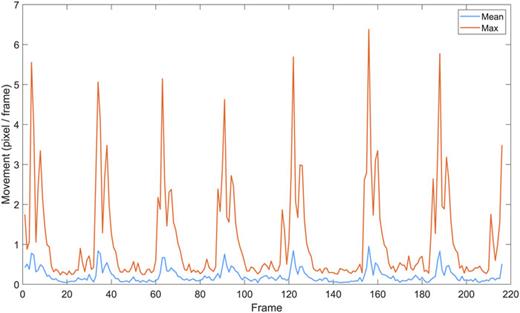 A visual detection method of cardiomyocyte relaxation and contraction ...