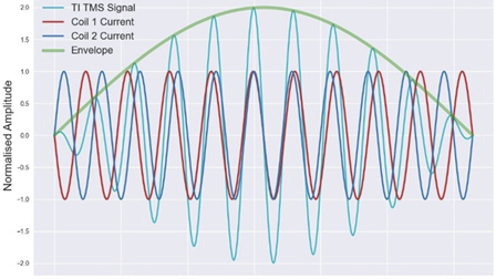 Temporal interference for dual site transcranial magnetic stimulation ...