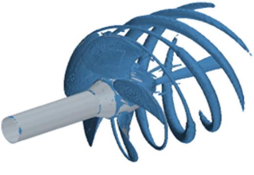 Numerical study on prediction and discrimination methods of propeller tip vortex cavitation ...
