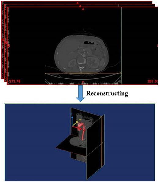 Hemodynamic simulation in the aortic arch with the lattice Boltzmann method | AIP Advances | AIP ...