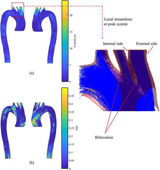 Hemodynamic simulation in the aortic arch with the lattice Boltzmann method | AIP Advances | AIP ...