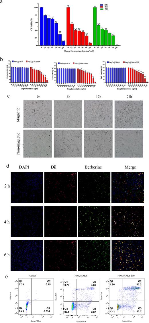 Preparation of berberine magnetic nanoparticles and their inhibition of ...