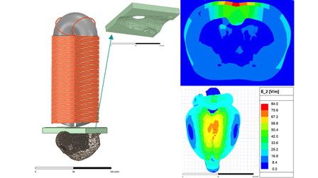 Novel multi-magnetic material transcranial magnetic stimulation coils ...