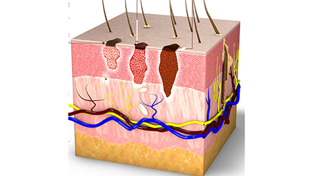 Early detection of skin cancer using AI: Deciphering dermatology images ...