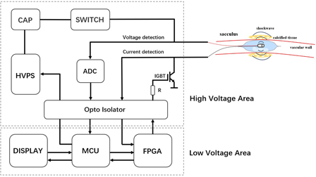 Accurate low-energy pulse system for intravascular lithotripsy | AIP ...
