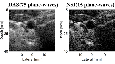 Frame rate improvement in coherent plane-wave compounding using null ...