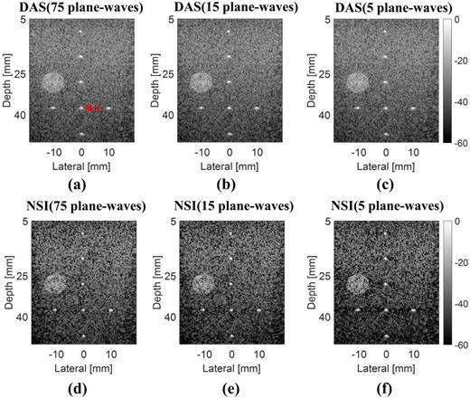 Frame rate improvement in coherent plane-wave compounding using null ...