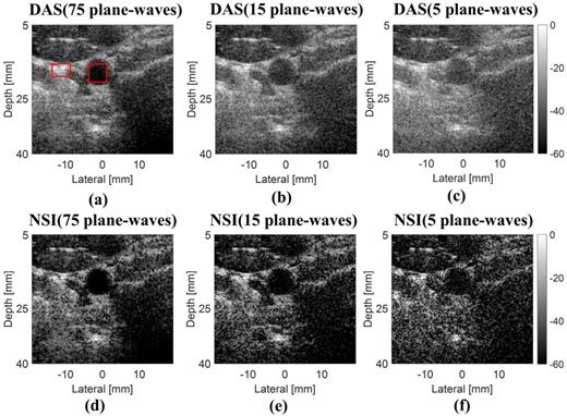 Frame rate improvement in coherent plane-wave compounding using null ...