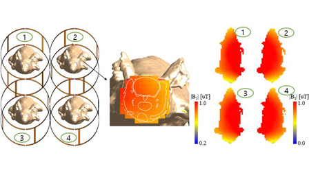 Extended curvature birdcage coil design for localized magnetic field in ...