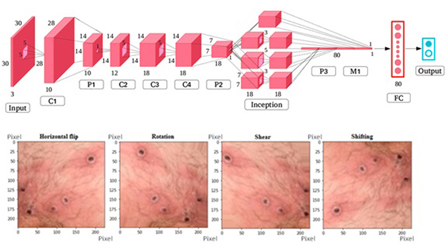 Classification of monkeypox images using Al-Biruni earth radius optimization with deep ...