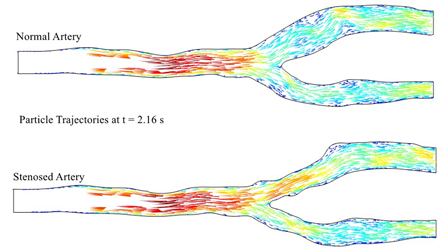 Unveiling hemodynamic pulsatile flow dynamics in carotid artery ...