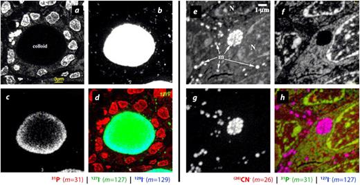 Analytical capabilities for iodine detection: Review of possibilities ...