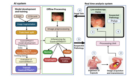 GastroNet: A CNN based system for detection of abnormalities in ...