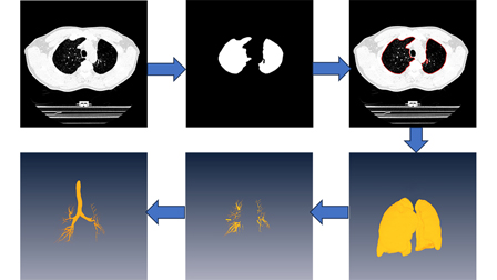 Research on hybrid segmentation technologies for postprocessing the ...