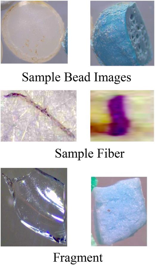 Automated Micro Plastic Detection And Classification Using Deep Convolution Neural Network Pre