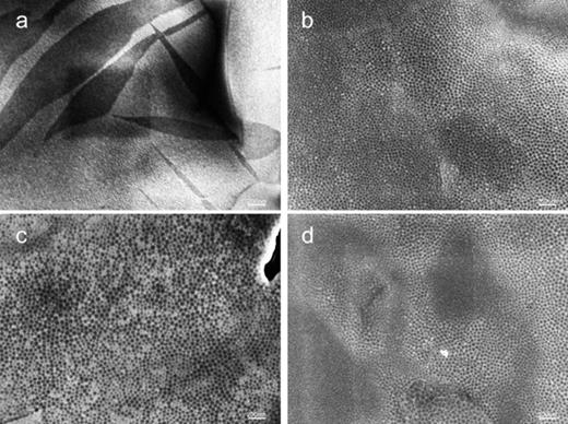 Ordered nano-scale dimple pattern formation on a titanium alloy (Ti-6Al ...