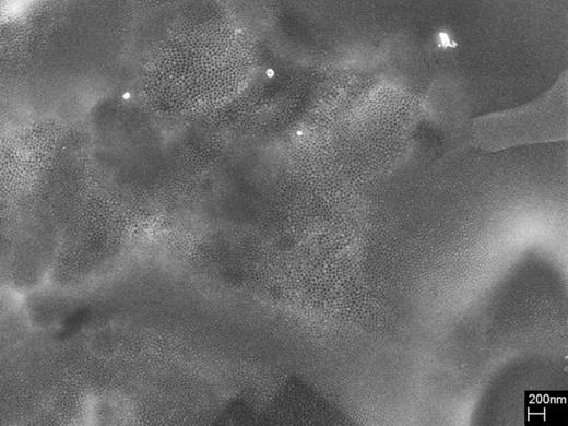 Ordered nano-scale dimple pattern formation on a titanium alloy (Ti-6Al ...