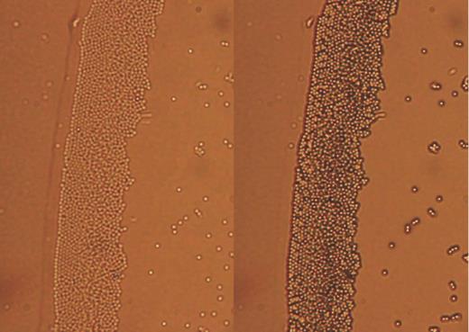 Ring formation from a drying sessile colloidal droplet | AIP Advances ...