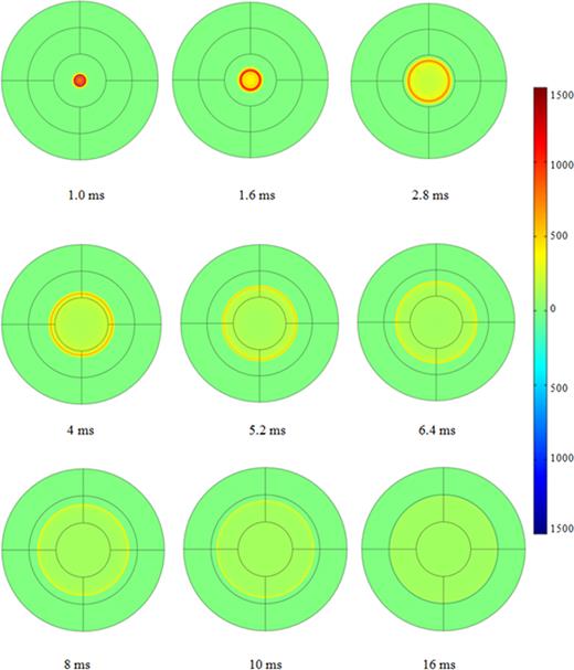 Interior acoustic cloak | AIP Advances | AIP Publishing