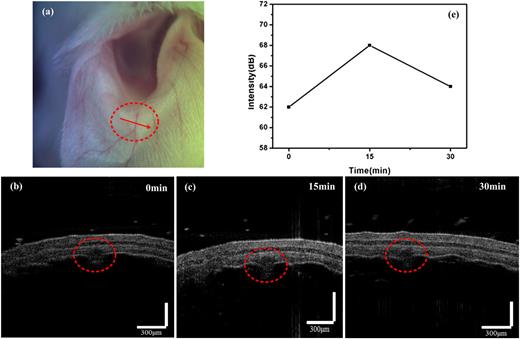 Characterizing physical properties and in vivo OCT imaging study of Cu ...