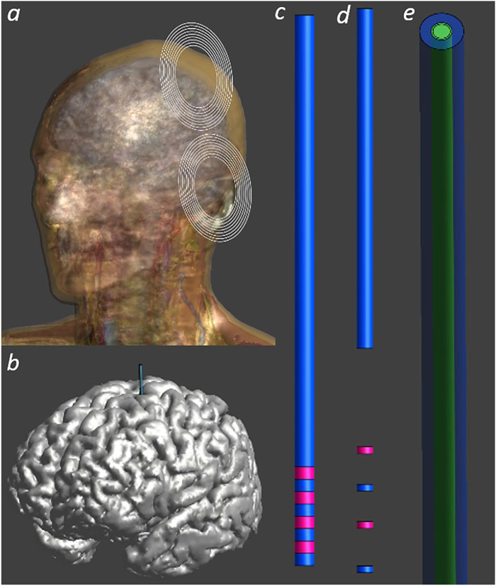 Computational analysis of transcranial magnetic stimulation in the ...
