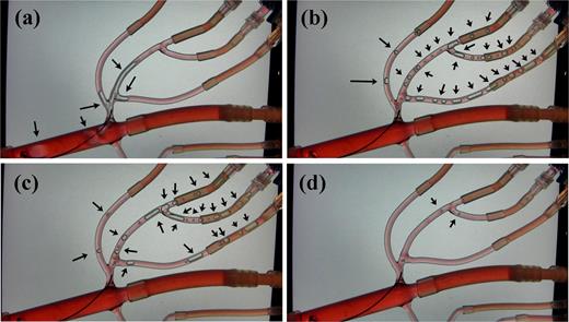 Carbon dioxide coronary angiography: A mechanical feasibility study ...
