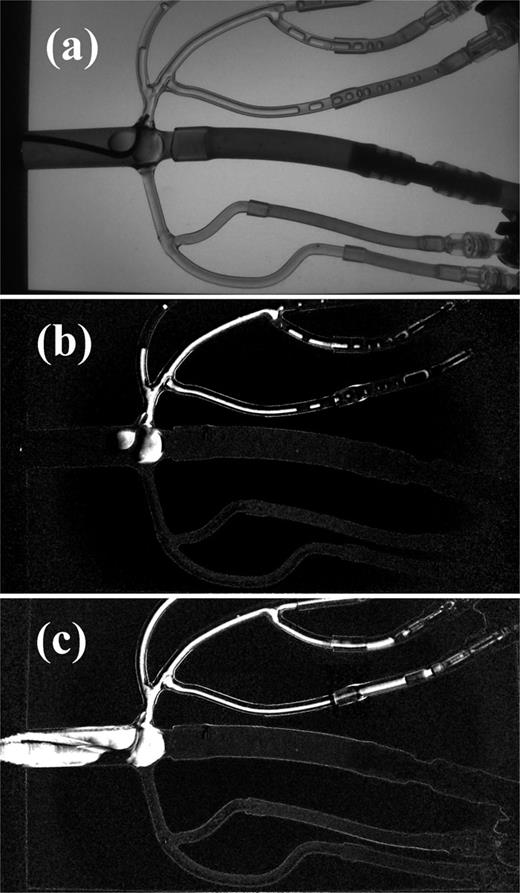 Carbon dioxide coronary angiography: A mechanical feasibility study ...