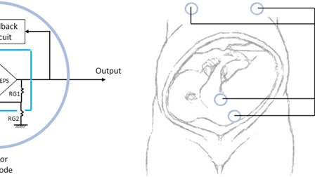Non-invasive recordings of fetal electrocardiogram during pregnancy ...