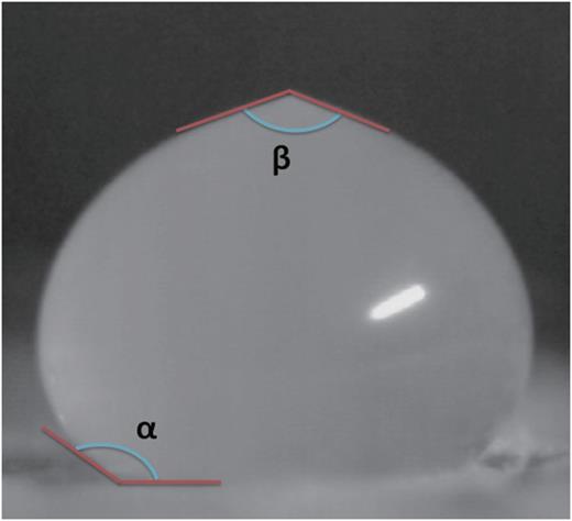 Morphology of supercooled droplets freezing on solid surfaces | AIP ...