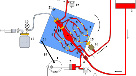 Movement compensation during carbon dioxide coronary angiography: In ...