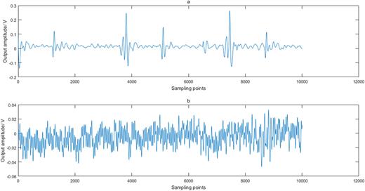 Design of a high SNR electronic heart sound sensor based on a MEMS ...