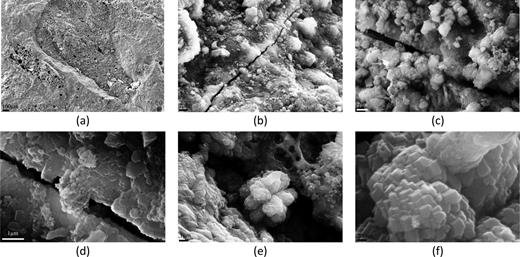 Bacterial self healing cement based materials: Mechanism at nanoscale ...