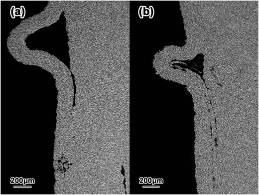 Analysis of inner fold and bulge defects on J55 steel for oil casing ...