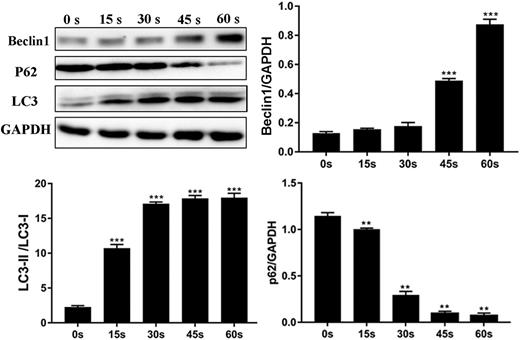 Helium low temperature plasma induced HepG2 cells autophagy through ROS ...