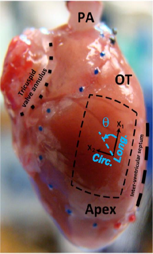 Transmural remodeling of right ventricular myocardium in response to ...