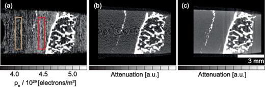 Implementation of a double-grating interferometer for phase-contrast computed tomography in a ...
