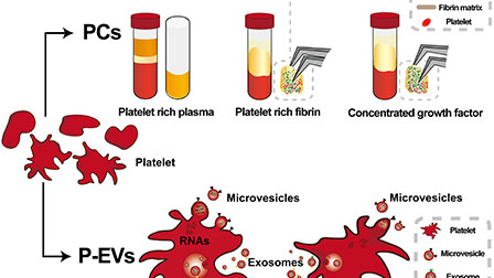 Emerging roles of platelet concentrates and platelet-derived ...