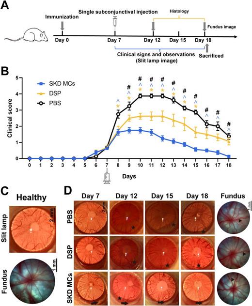 Long-acting acid-sensitive ketal-linked dexamethasone microcrystals for ...