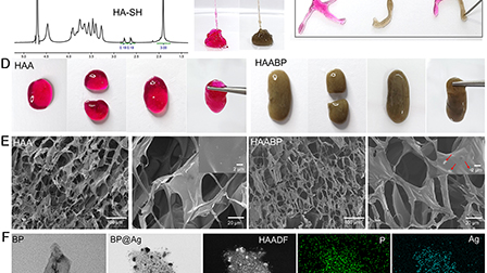Black phosphorus-enhanced injectable hydrogel for infected soft tissue ...