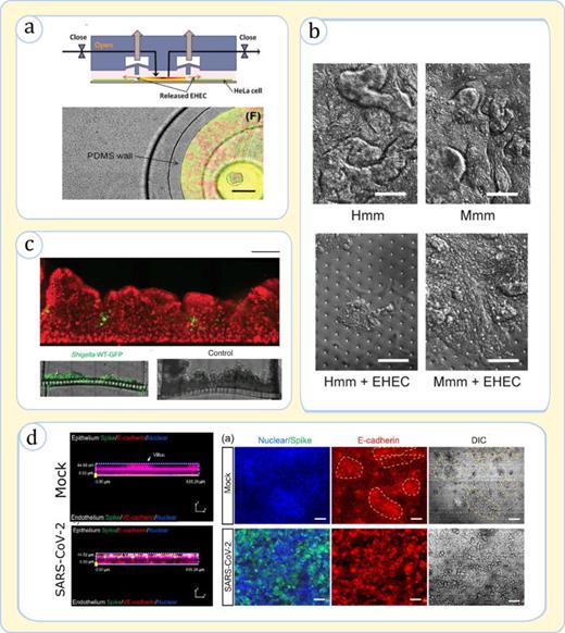 Gut-on-a-chip models for dissecting the gut microbiology and physiology ...