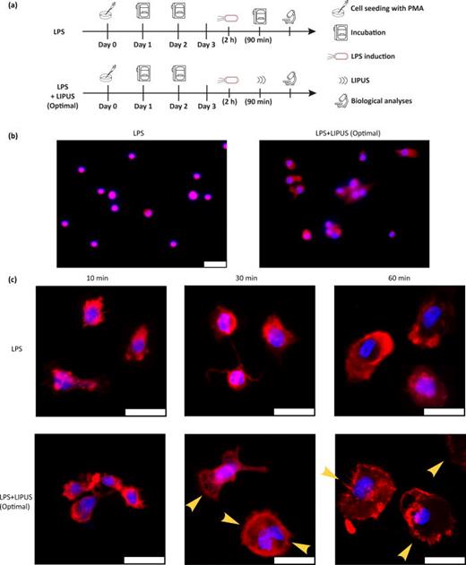Optimal low-intensity pulsed ultrasound stimulation for promoting anti ...