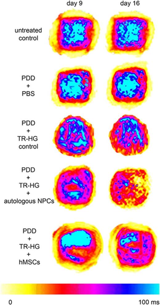 The role of biomechanical factors in models of intervertebral disc ...
