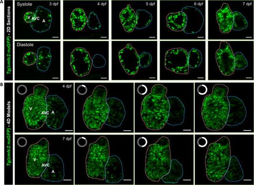 4D Light-sheet imaging and interactive analysis of cardiac ...