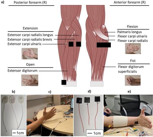 Surface electromyography using dry polymeric electrodes | APL Bioengineering | AIP Publishing